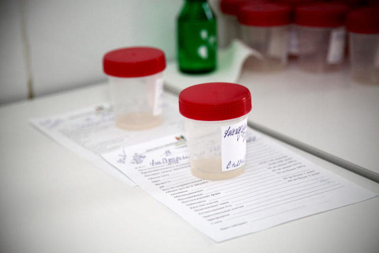 МАР-тест: що це таке і коли його потрібно робити, як складати і які норми?